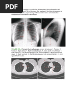 Head Cheese Sign - Print Friendly - STATdx | PDF | Respiratory Diseases ...