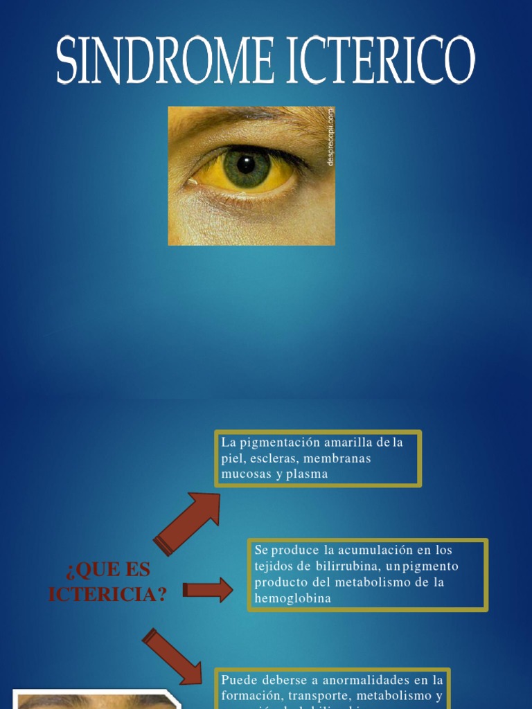 Sindrome Icterico | PDF | Hígado | Especialidades Medicas