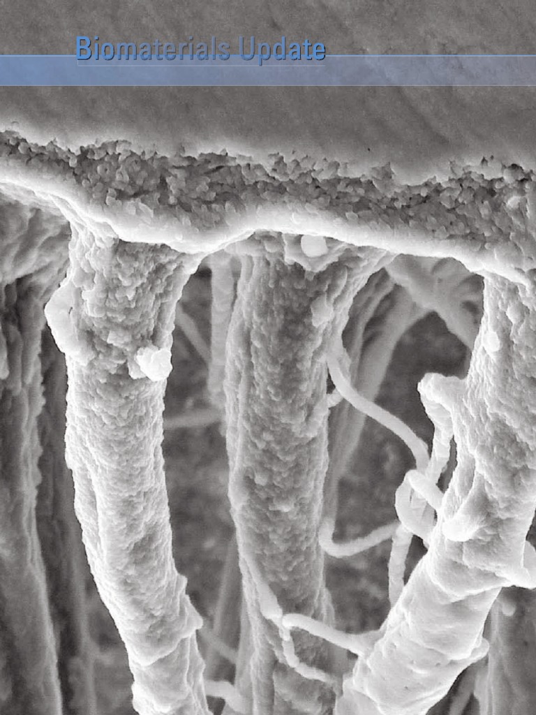 Adhesive Resin Cements For Bonding Esthetic Restorations - A Review PDF ...