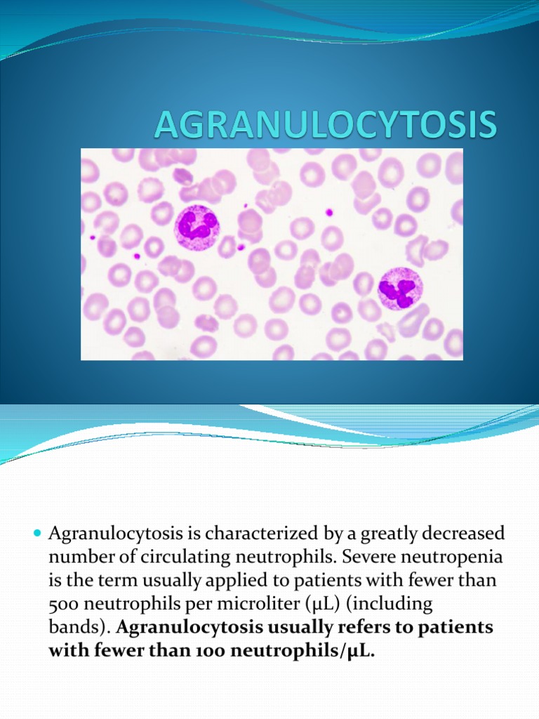 Agranulocytosis Final | PDF | Infection | Epidemiology