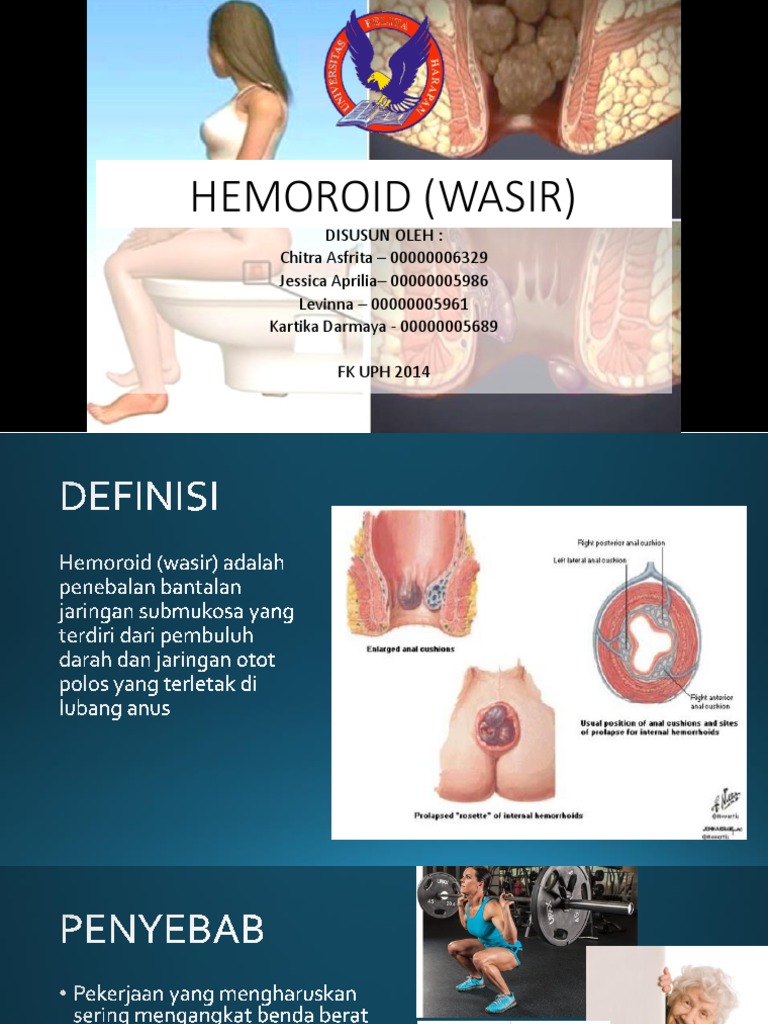 Hemoroid PPT (Wasir) | PDF