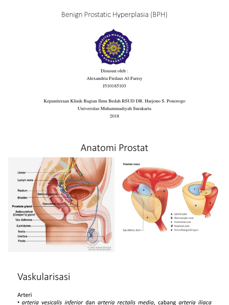 Tutorial Klinik BPH | PDF | Pengembangan Diri | Sains & Matematika