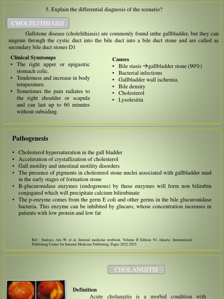 Cholelithiasis: Clinical Symtomps Causes | Download Free PDF | Bile | Gallbladder