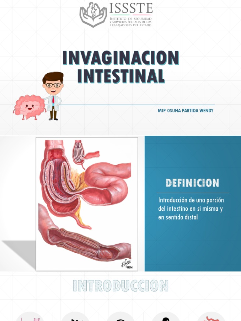 Invaginacion Intestinal | PDF | Gastroenterología | Enfermedades y ...