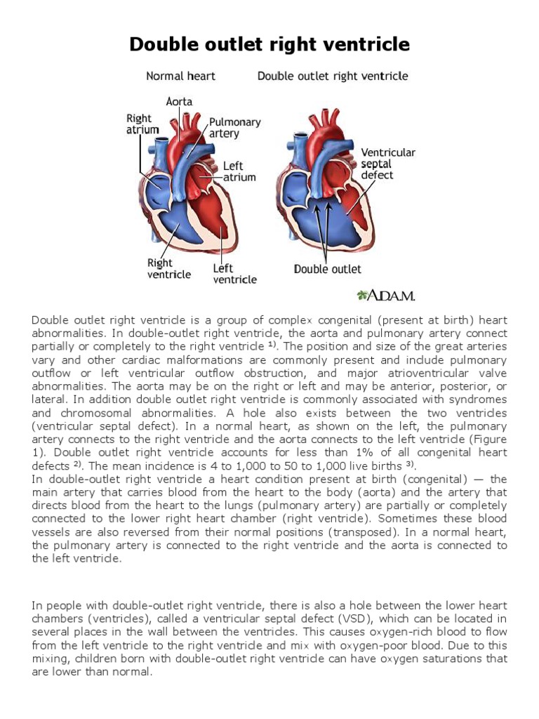 Case Study: Double Outlet Right Ventricle | PDF | Congenital Heart ...