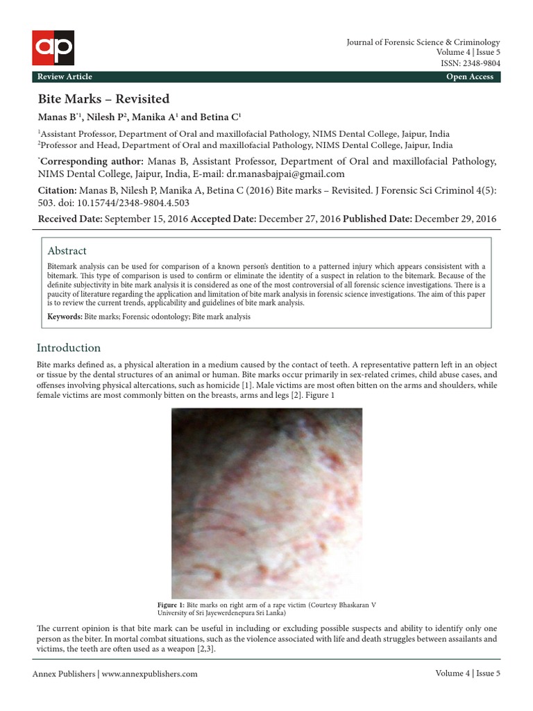 Bite Mark Analysis in Forensic Science | PDF