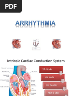 Pac PJC PVC | PDF | Cardiac Electrophysiology | Cardiac Arrhythmia