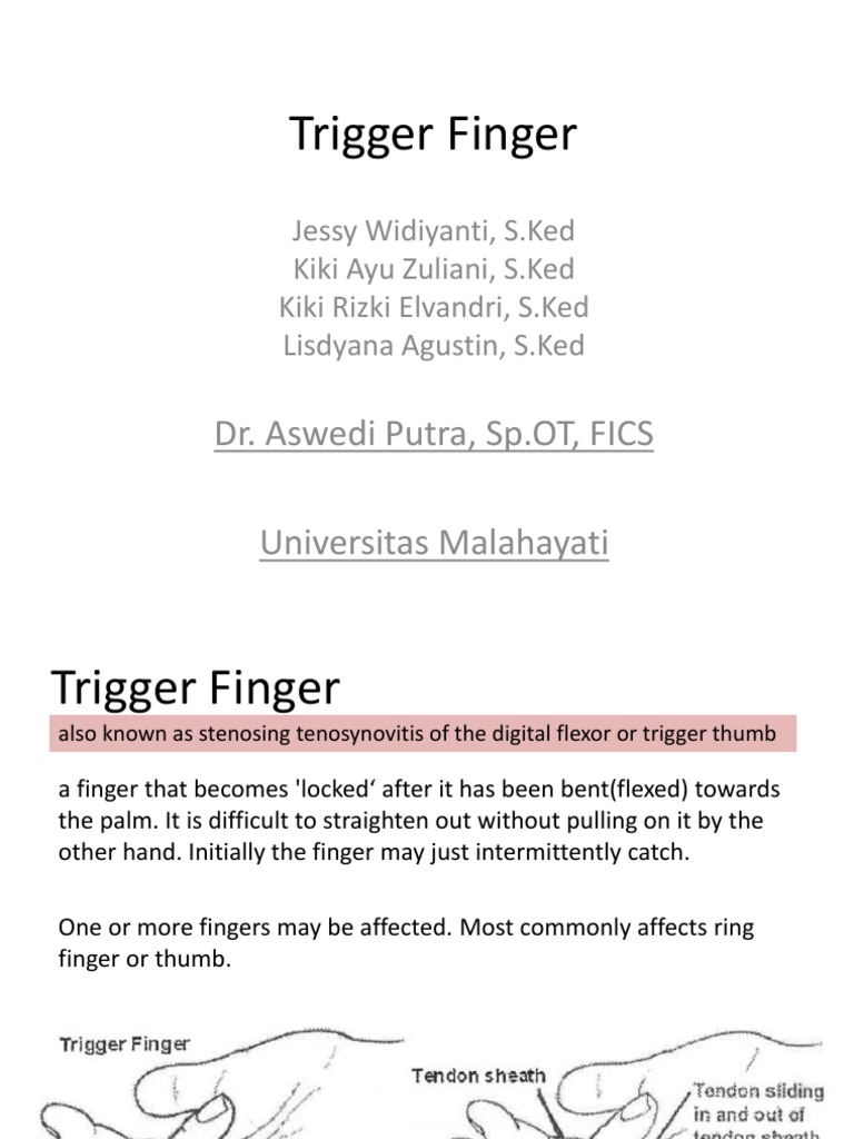Trigger Finger | PDF | Finger | Hand