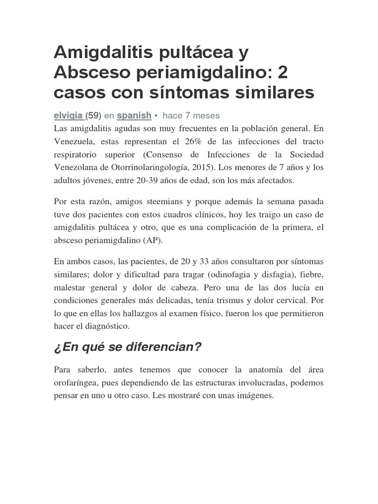 Absceso periamigdalino | Enfermedades y trastornos | Rtt