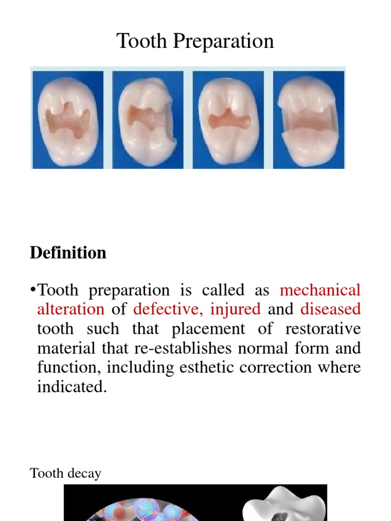 Tooth Preparation | PDF | Human Tooth | Tooth Enamel