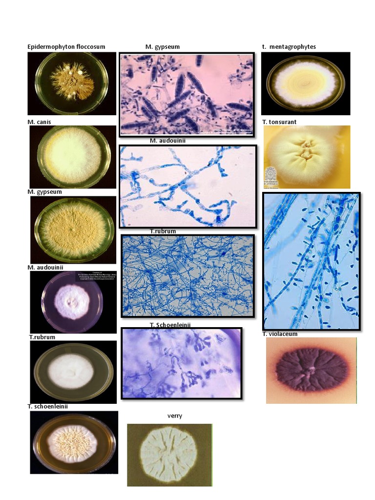 Epidermophyton floccosum.docx