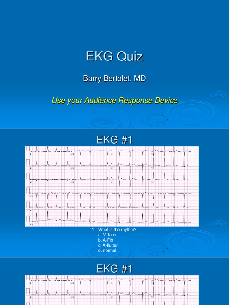 EKG Quiz: Use Your Audience Response Device | PDF | Electrocardiography ...
