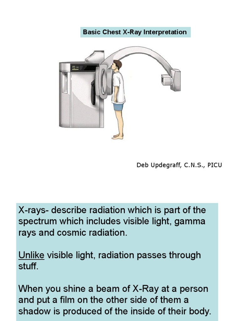 Chest X-Rays PDF | PDF