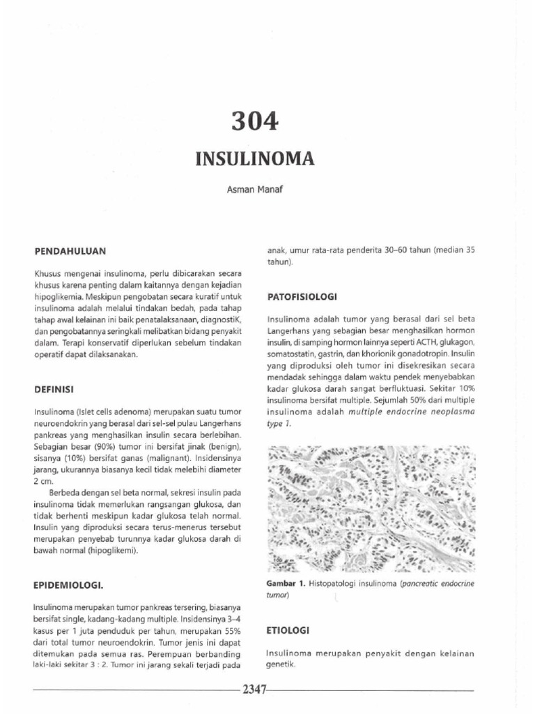 Insulinoma | PDF