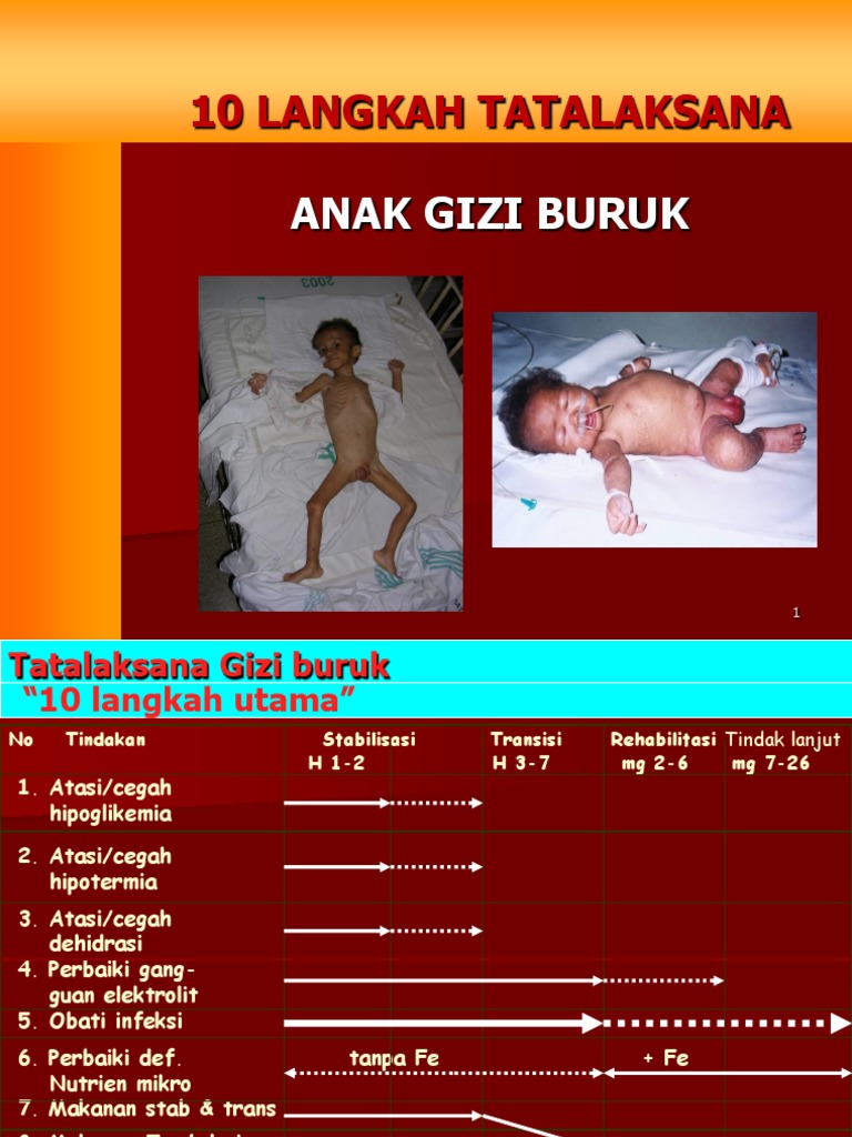 Tatalaksana Gizi Buruk Terbaru | PDF