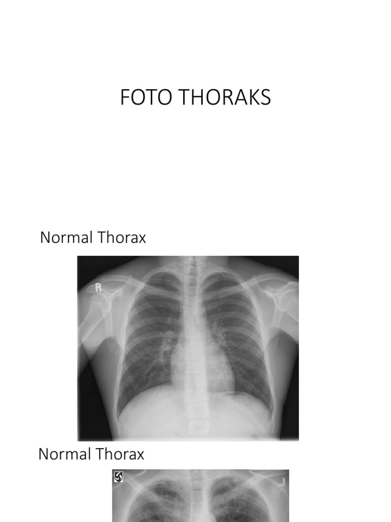 Foto Thorax | PDF | Kajian Bahasa Asing