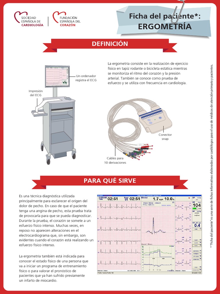 Una guía completa sobre la ergometría: qué es, para qué sirve y cómo se ...