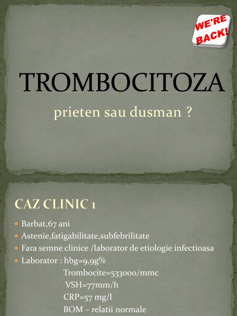 Claudia Nicorici Trombocitoza. | PDF