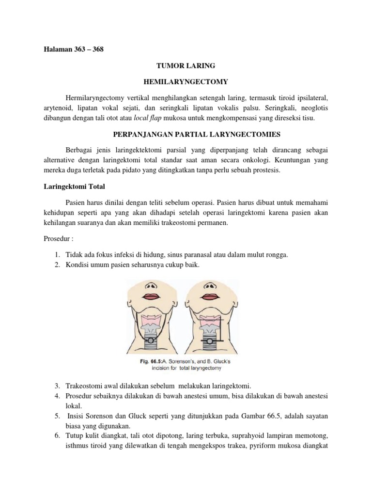 Tumor Laring | PDF