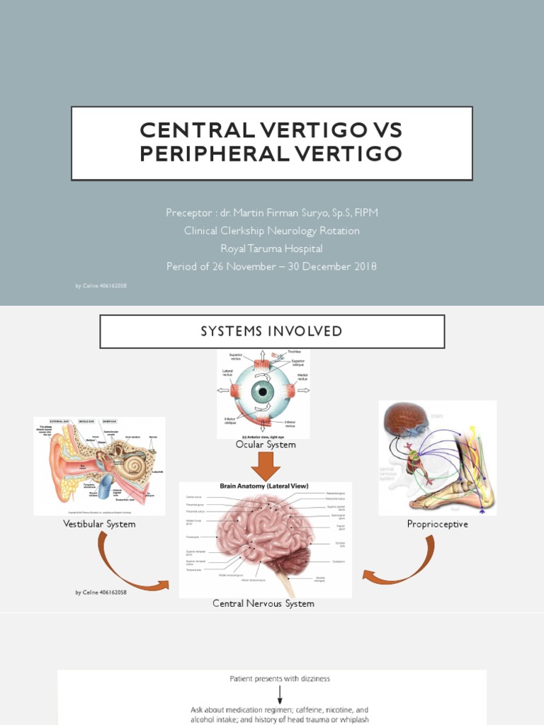 Central Vertigo Vs Peripheral Vertigo | PDF