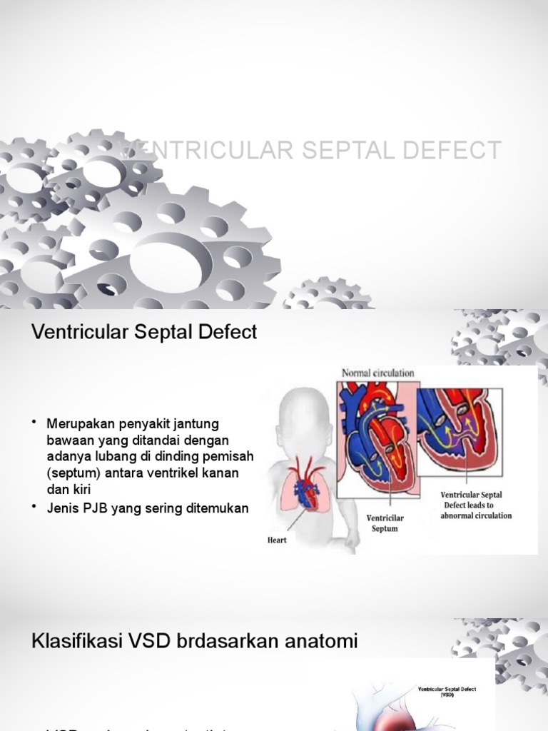 Ventricular Septal Defect: Diagnosis dan Tatalaksana | PDF ...