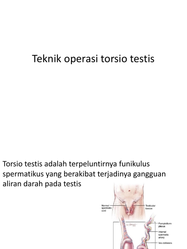 Teknik Operasi Torsio Testis | PDF