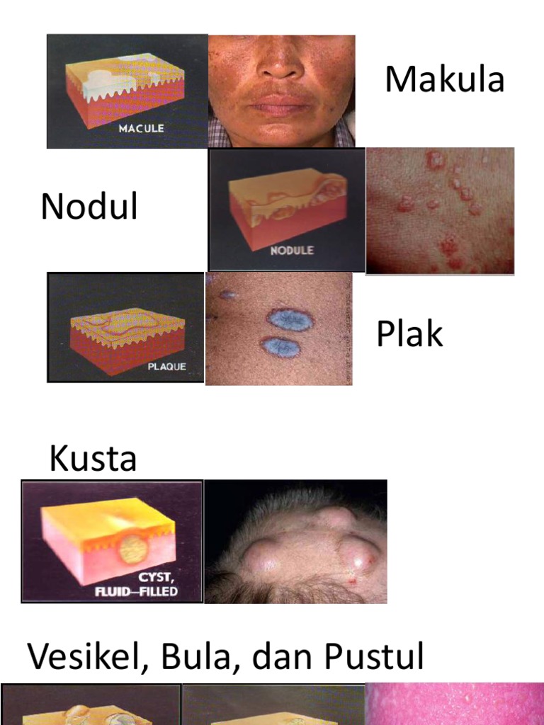 Jenis - Jenis Ruam | PDF