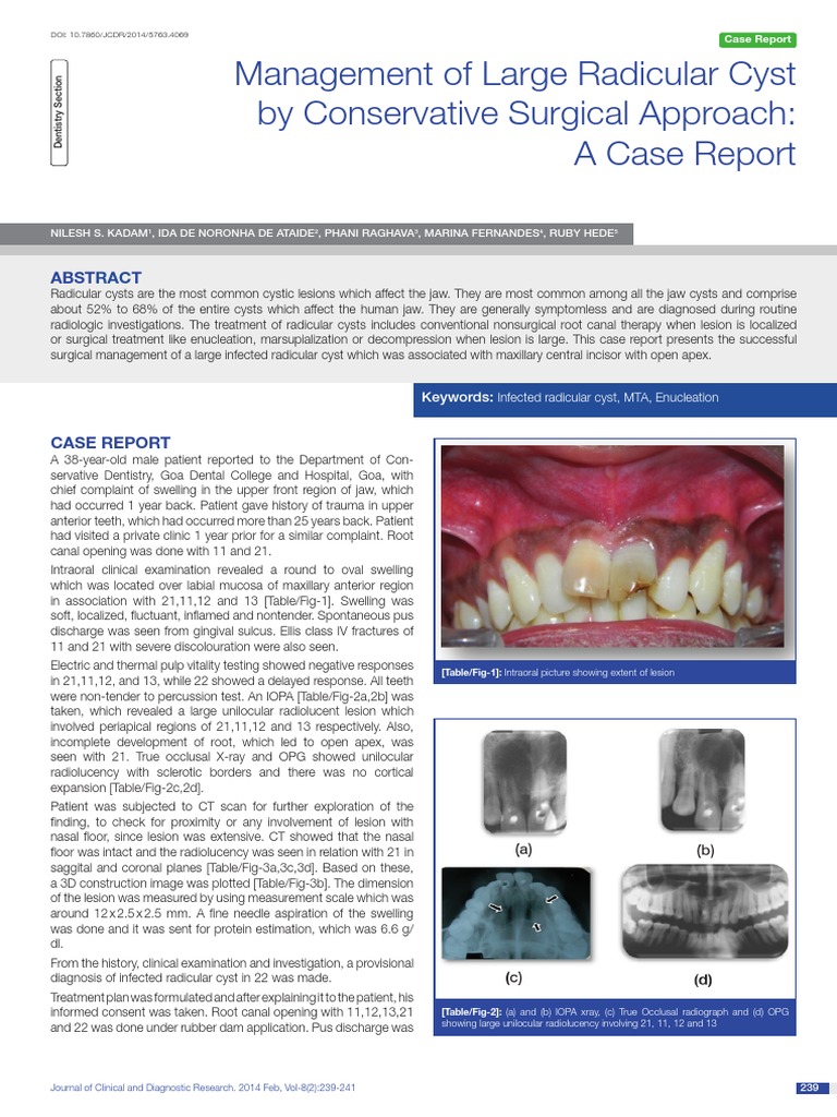 Management of Large Radicular Cyst by Conservative Surgical Approach ...