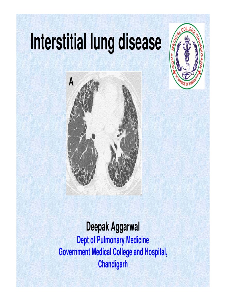 Pneumonie Interstitiala Articol Engleza | Download Free PDF | Clinical ...