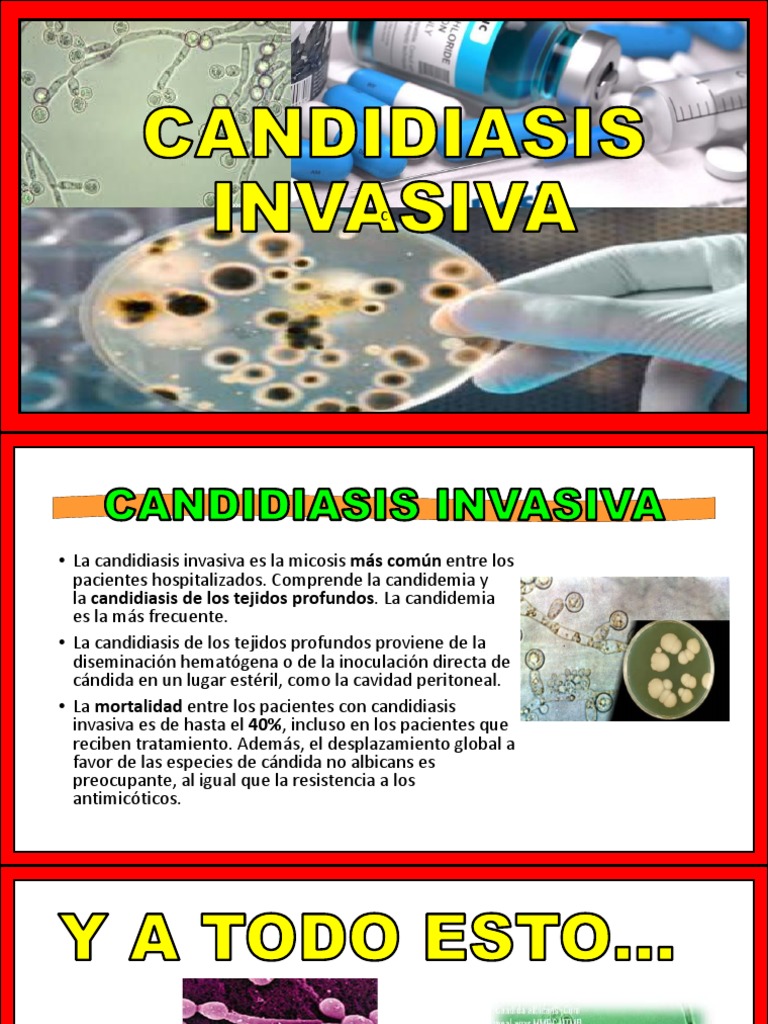 Candidiasis Invasiva: Definición y Tratamiento | PDF | Candidiasis ...