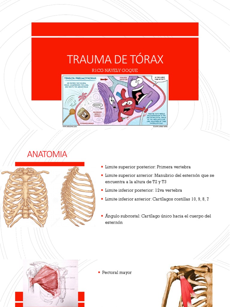 Trauma De Tórax: R1Cg Nayely Goque | Tórax | Tórax (anatomía humana)