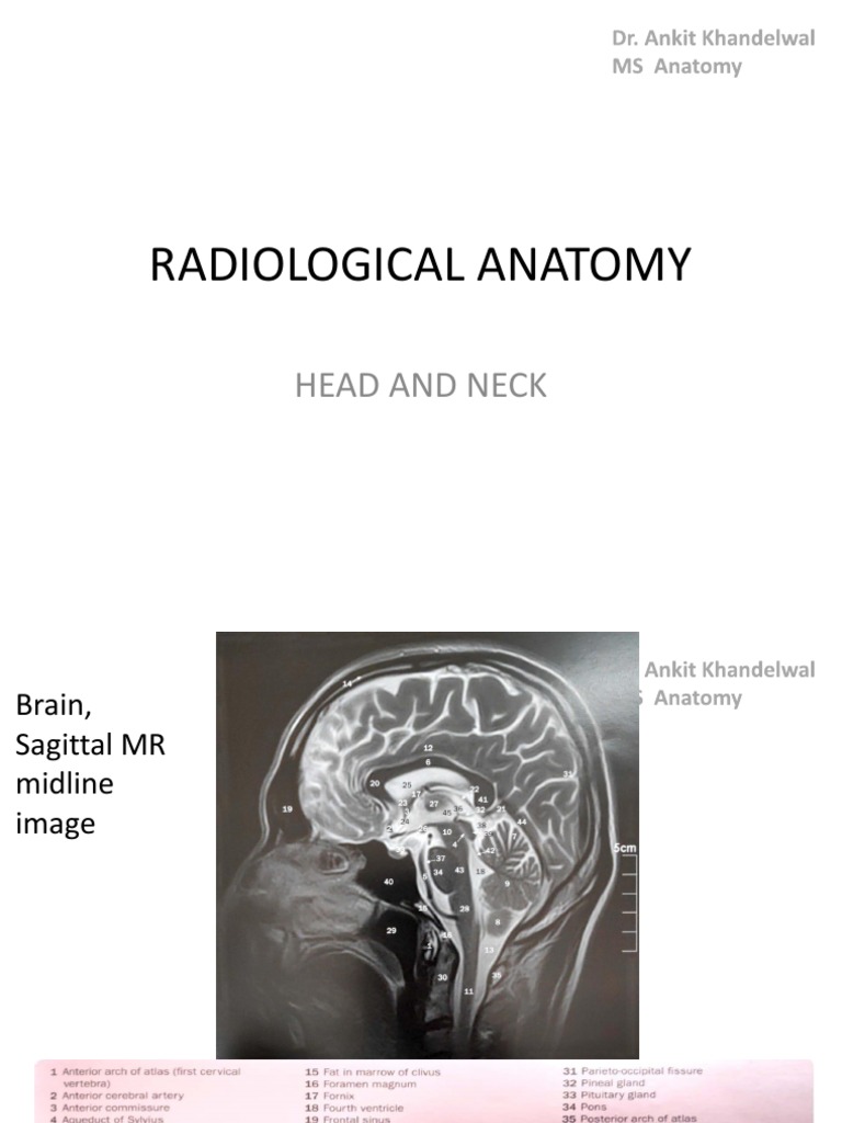 Radiological Anatomy: Head and Neck | PDF