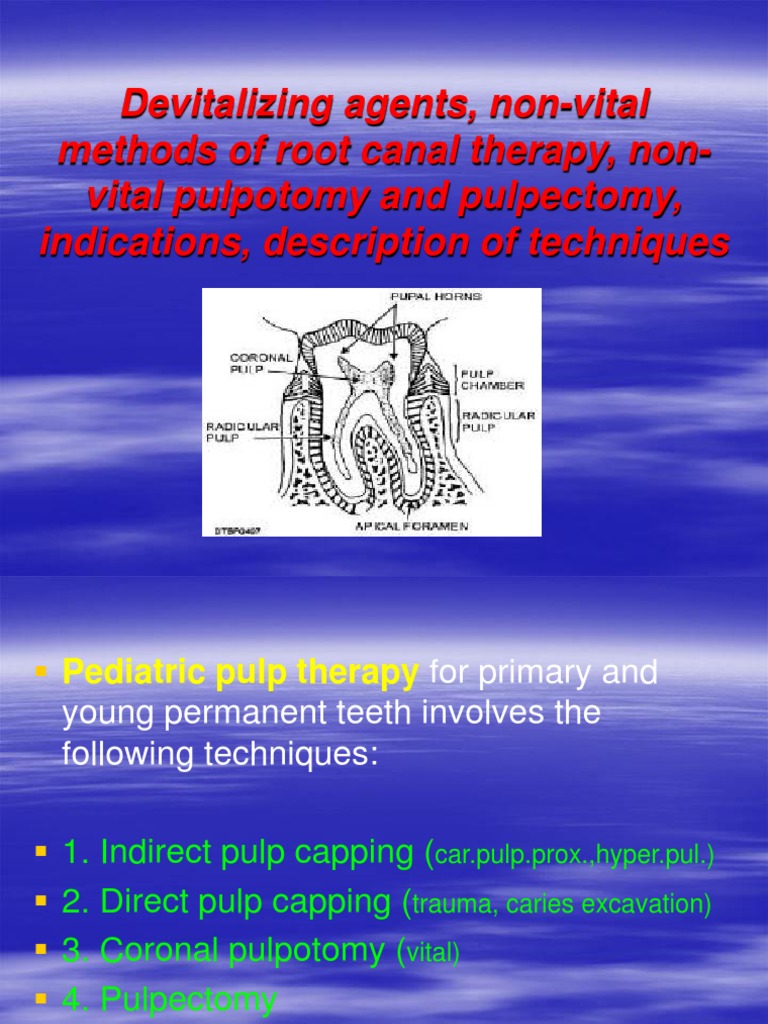 Devitalizing Agents, Non-Vital Methods of Root Canal Therapy, Non-Vital ...