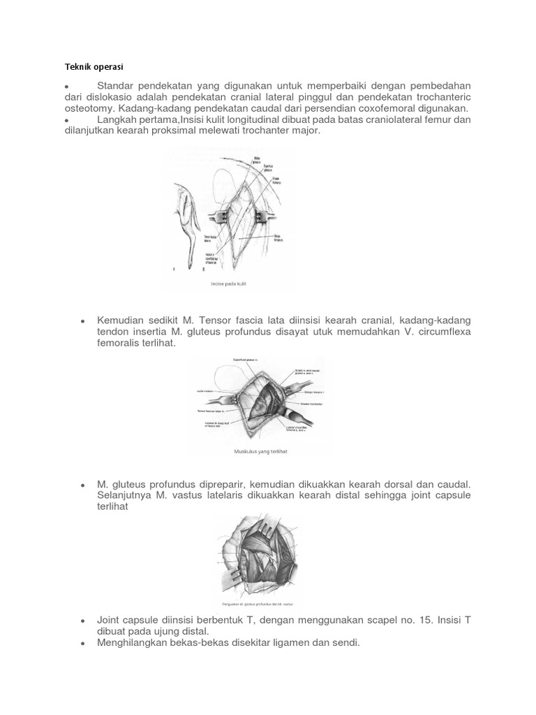 Teknik Operasi | PDF