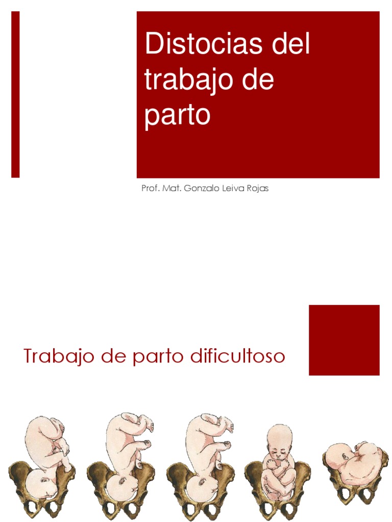 Distocias de Parto 2015 | PDF | Parto | Seccion de cesárea