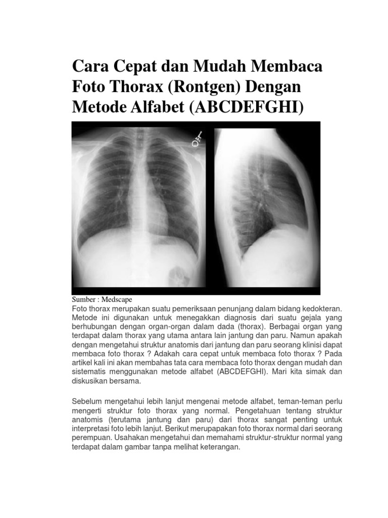 Cara Cepat Dan Mudah Membaca Foto Thorax | PDF