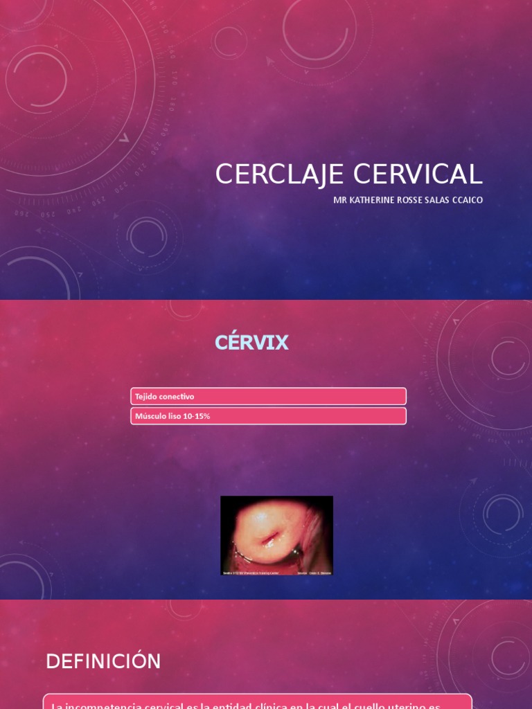 Cerclaje Cervical: ¿Qué Es Y Cómo Se Realiza La Cirugía? – FYKV