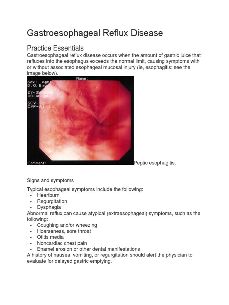 Gastroesophageal Reflux Disease | PDF