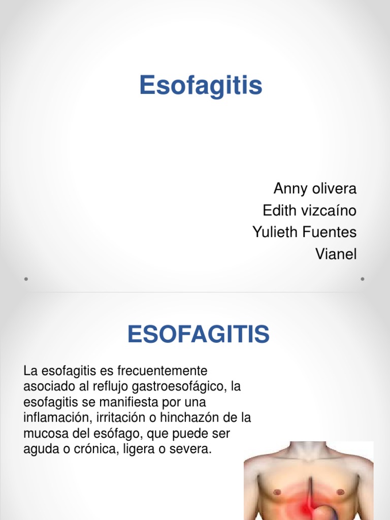 Esofagitis | PDF | La enfermedad por reflujo gastroesofágico ...