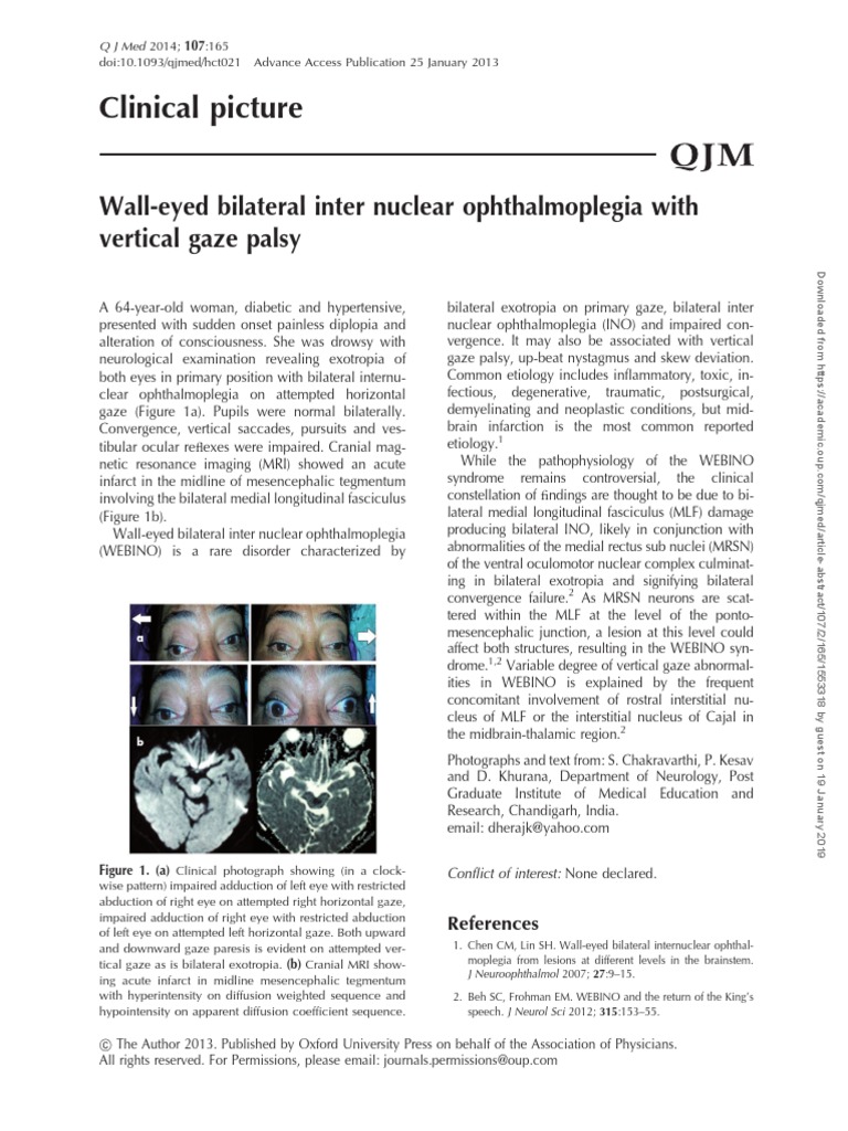 Ino 1 | PDF | Nervous System | Diseases And Disorders