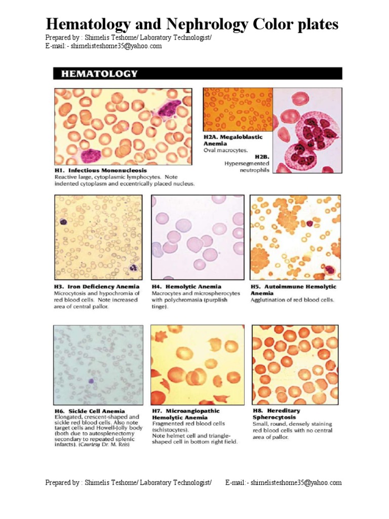 Hematology and Nephrology Color Plates | PDF | Language Arts ...