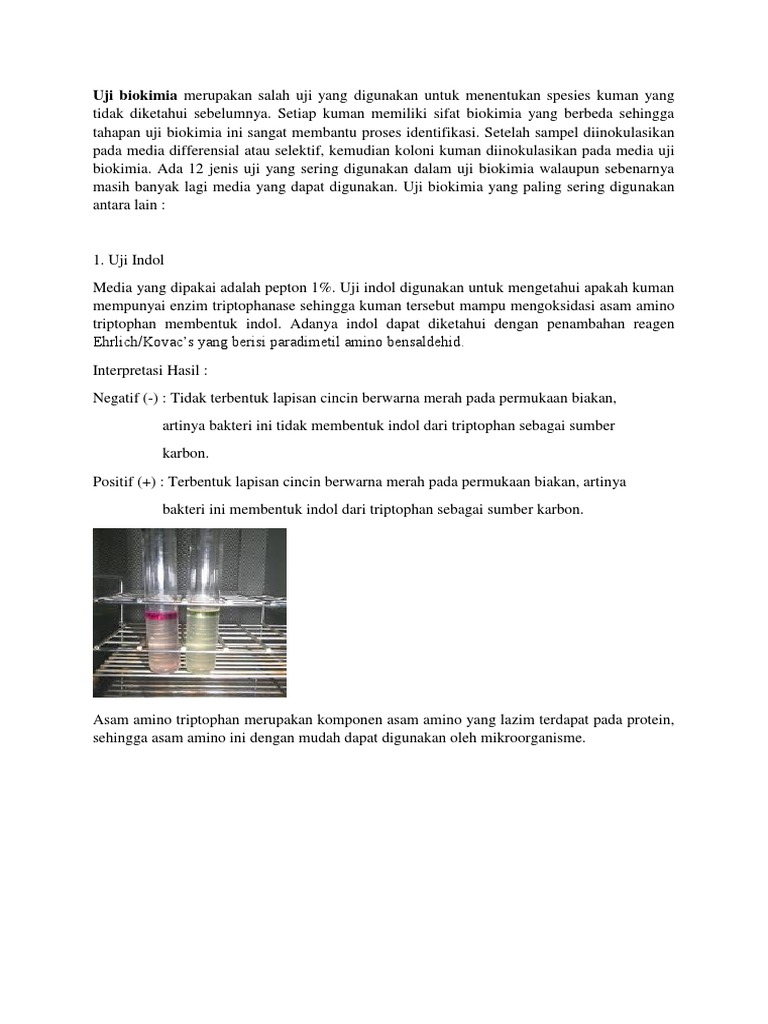 Uji biokimia mengidentifikasi kuman | PDF