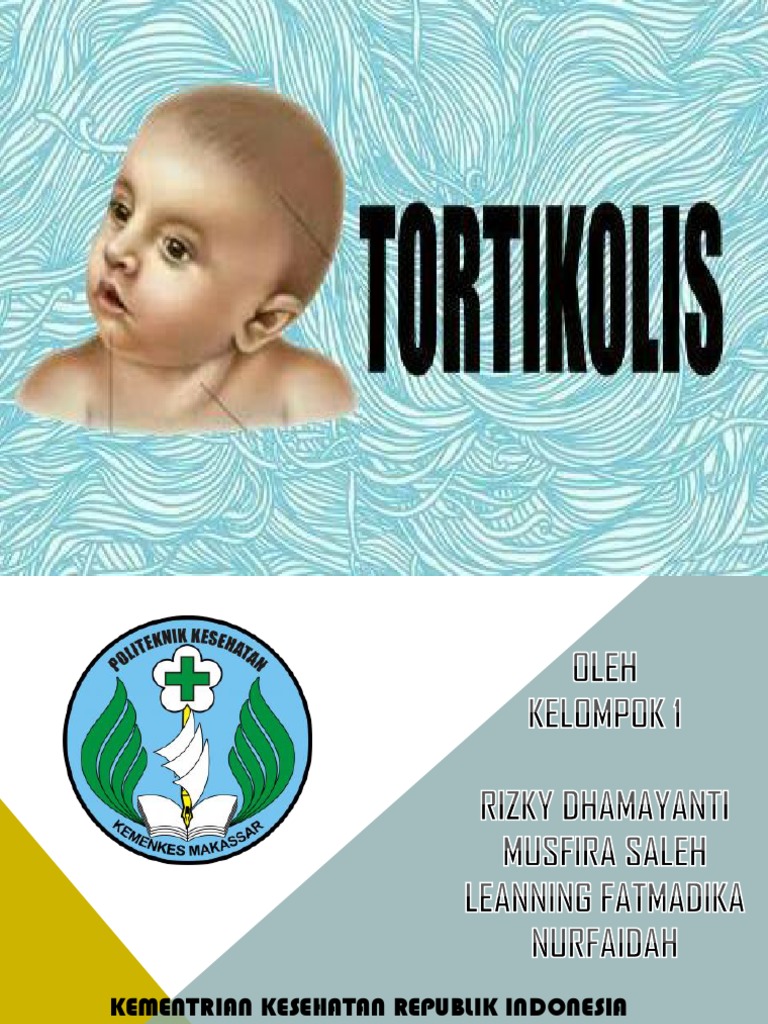 Tortikolis | PDF