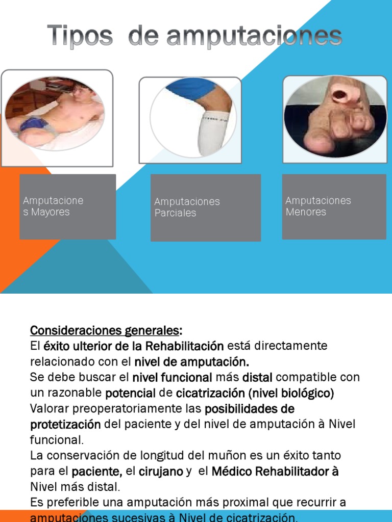 9 Amputaciones | PDF | Amputación | Pie