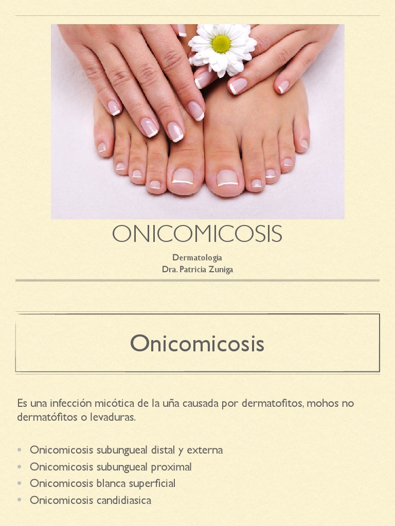 Onicomicosis | PDF | Candidiasis | Rtt