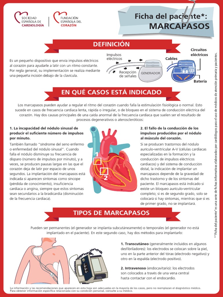 marcapasos | Marcapasos cardíacos artificiales | Corazón