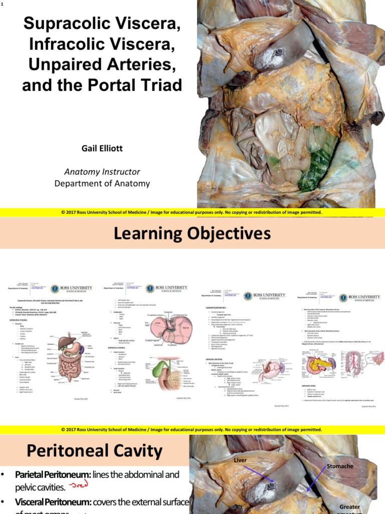Dissection Supracolic & Infracolic | PDF | Peritoneum | Liver