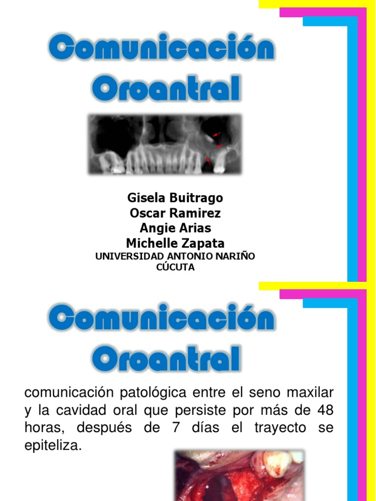 Comunicacion Oroantral | PDF | Diente | Boca