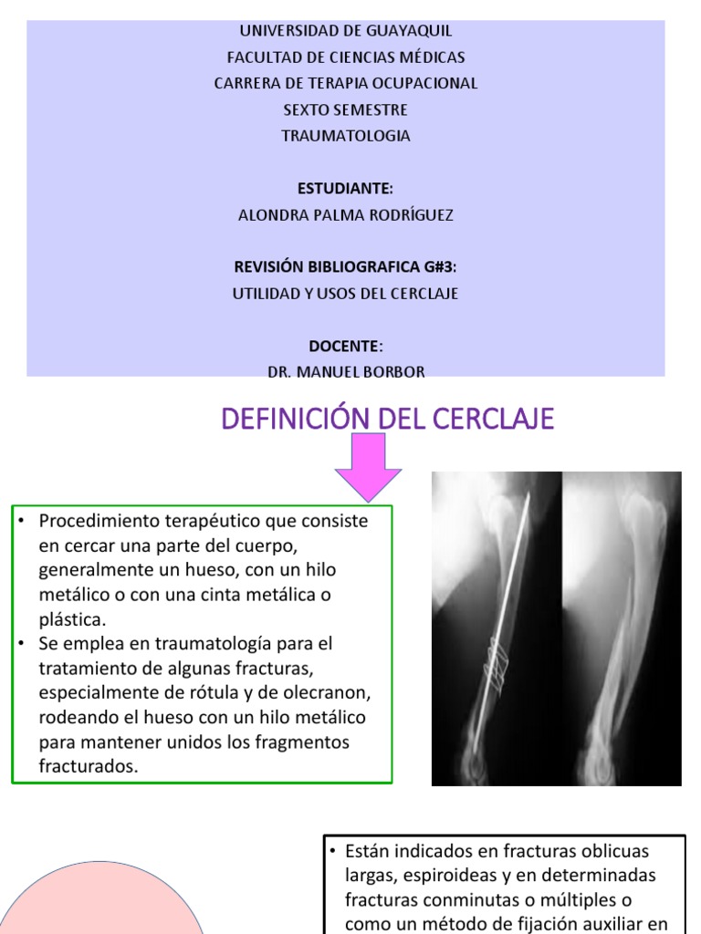 Usos y Tipos de Cerclaje en Traumatología | PDF