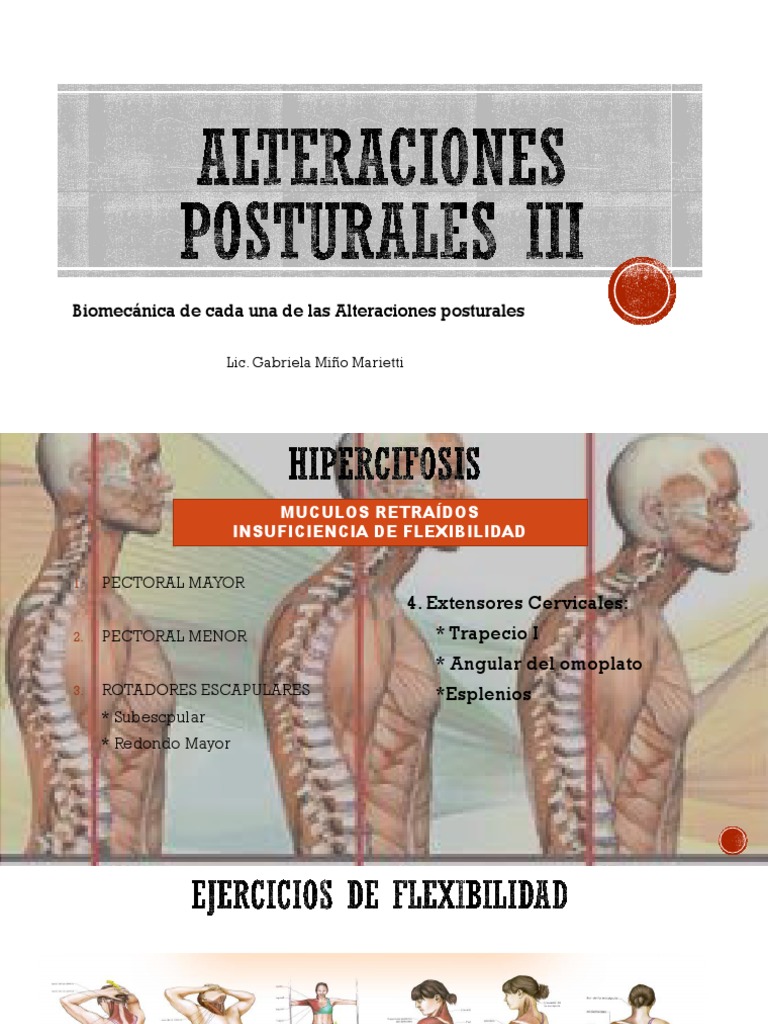 5 Alteraciones Posturales Iii | PDF | Vértebra | Escoliosis